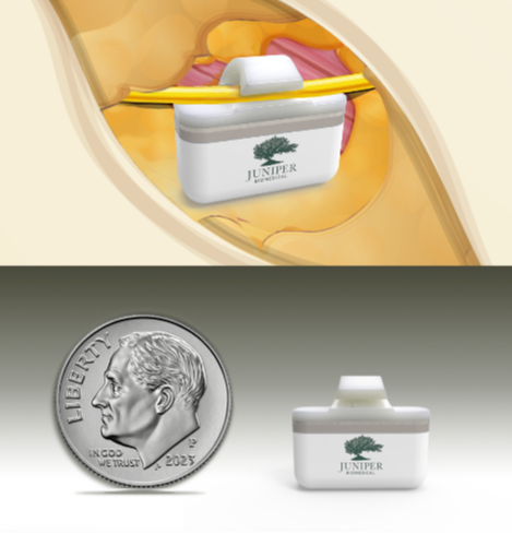 Revolutionizing Pelvic Health Therapy Juniper Biomedical